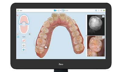 Dentist in Mentor, Ohio | DeCastecker Dental Specialists DDS